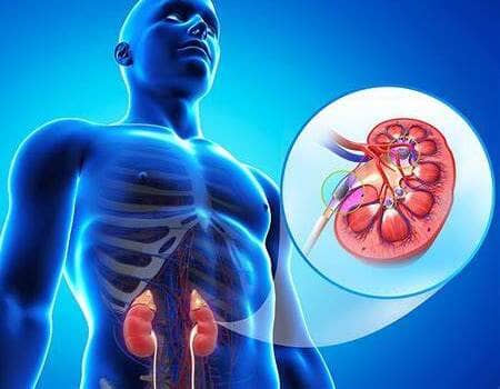 Urologista em Goiânia | Cálculo Renal | Dr. Wagner Kono